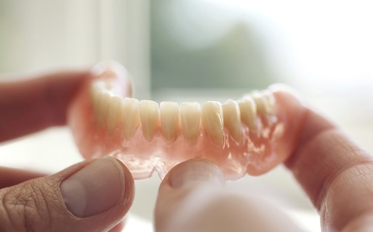 Lifespan of Dentures: How Long Do They Really Last?