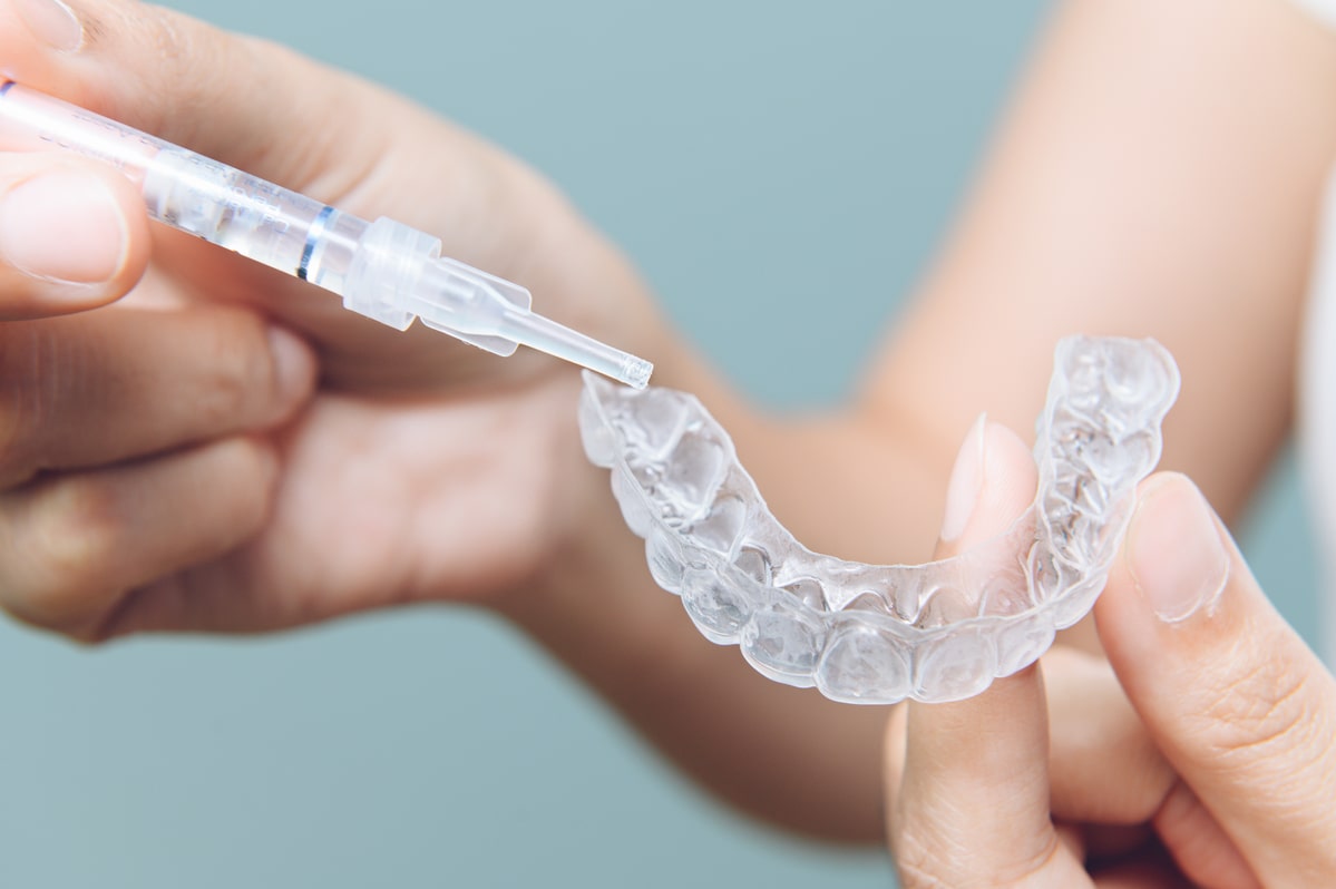 Invisalign & Teeth Whitening: Achieve Your Best Smile